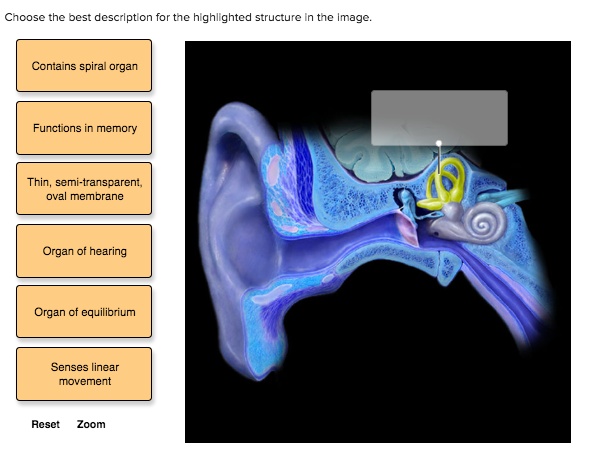 SOLVED: Choose the best description for the highlighted structure in ...