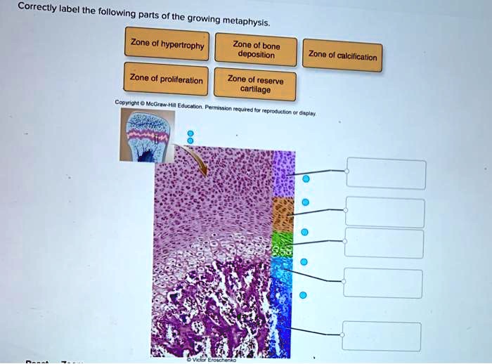SOLVED: Correctly label the following parts of the growing metaphysis ...