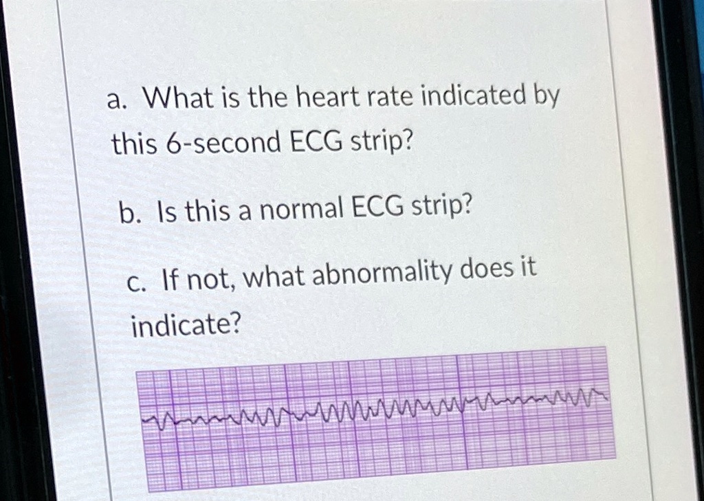 a. What is the heart rate indicated by this 6-second ECG strip? b. Is this a normal ECG strip? c ...