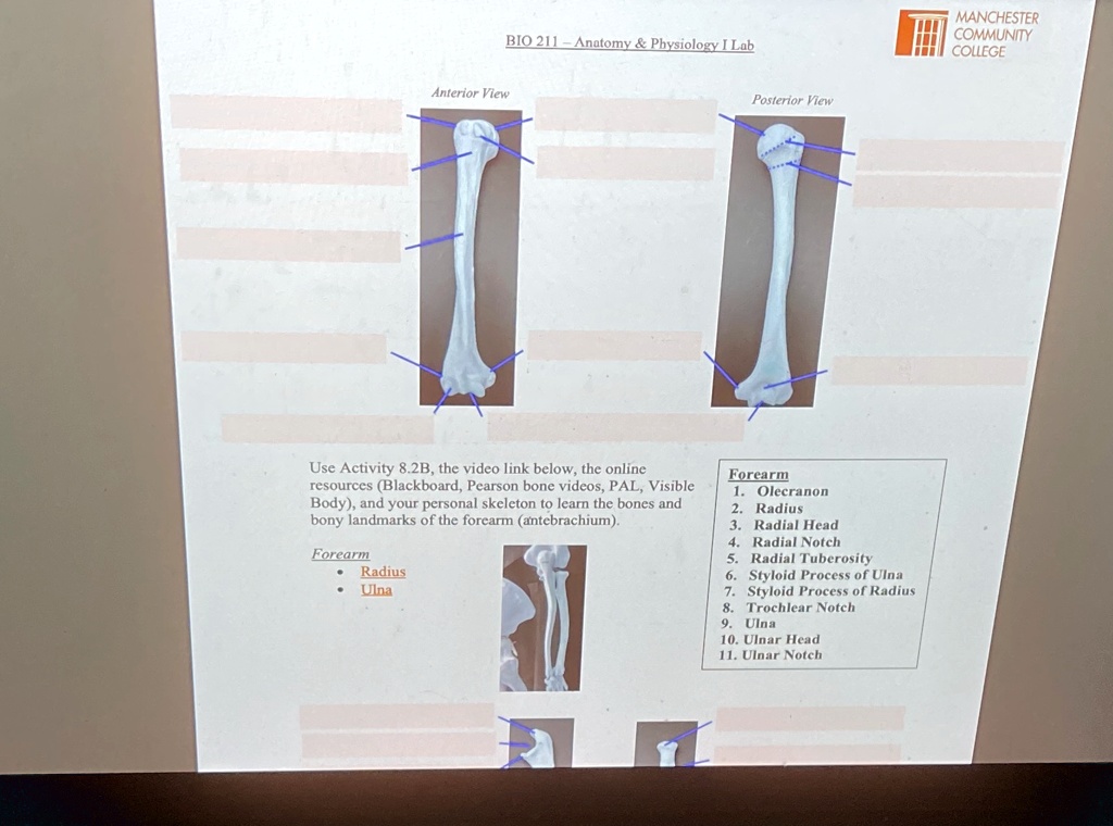 SOLVED: Label MANCHESTER COMMUNITY COLLEGE BIO 241 Anatomy Physiology ...