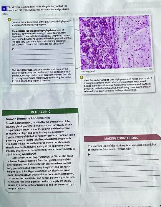 SOLVED: The diverse staining features in the pituitary reflect the ...
