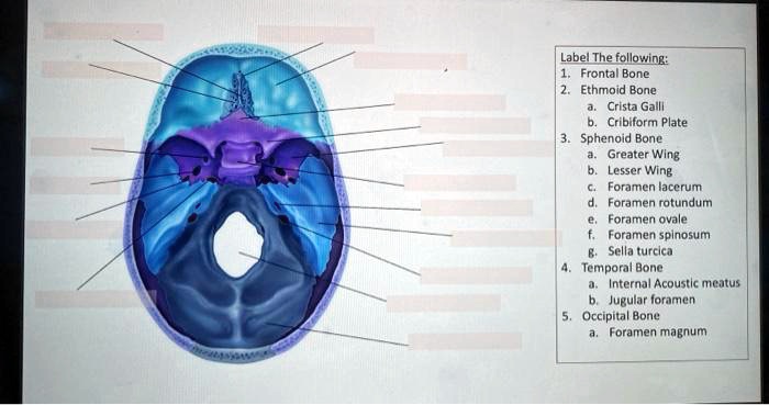 Label The following: 1. Frontal Bone 2. Ethmoid Bone a. Crista Galli b ...