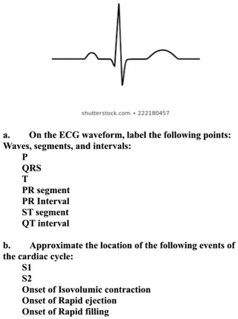 SOLVED: a. On the ECG waveform, label the following points: Waves, segments, and intervals: P ...