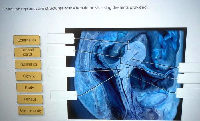 SOLVED: Label the reproductive structures of the female pelvis using ...