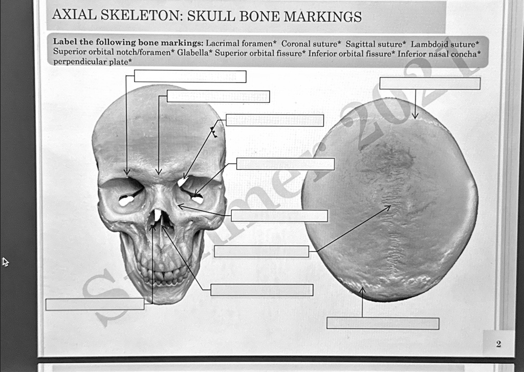 AXIAL SKELETON: SKULL BONE MARKINGS Label the following bone markings ...