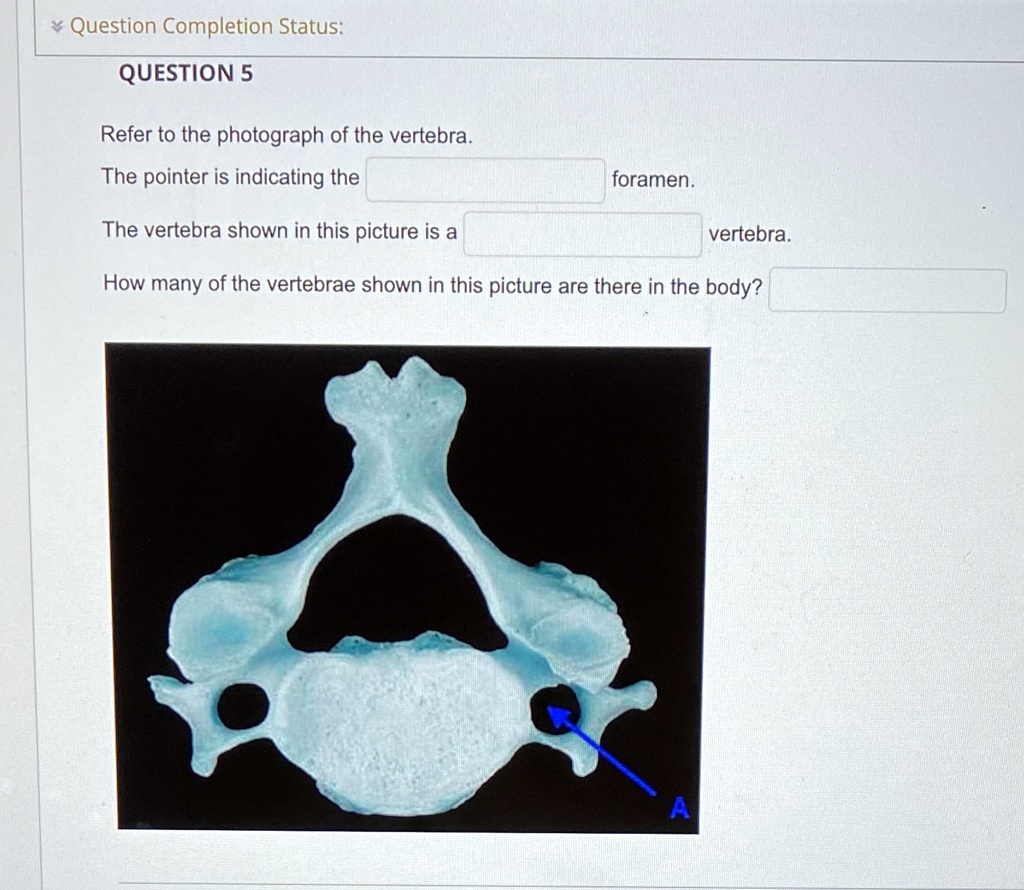 SOLVED: 'Question Completion Status: QUESTION 5 Refer to the photograph ... SOLVED: 'Question Completion Status: QUESTION 5 Refer to the photograph ...