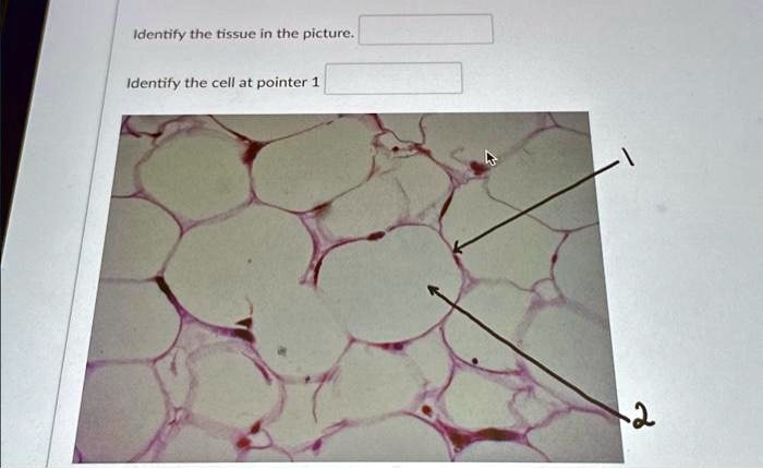 Identify the tissue in the picture. Identify the cell at pointer 1