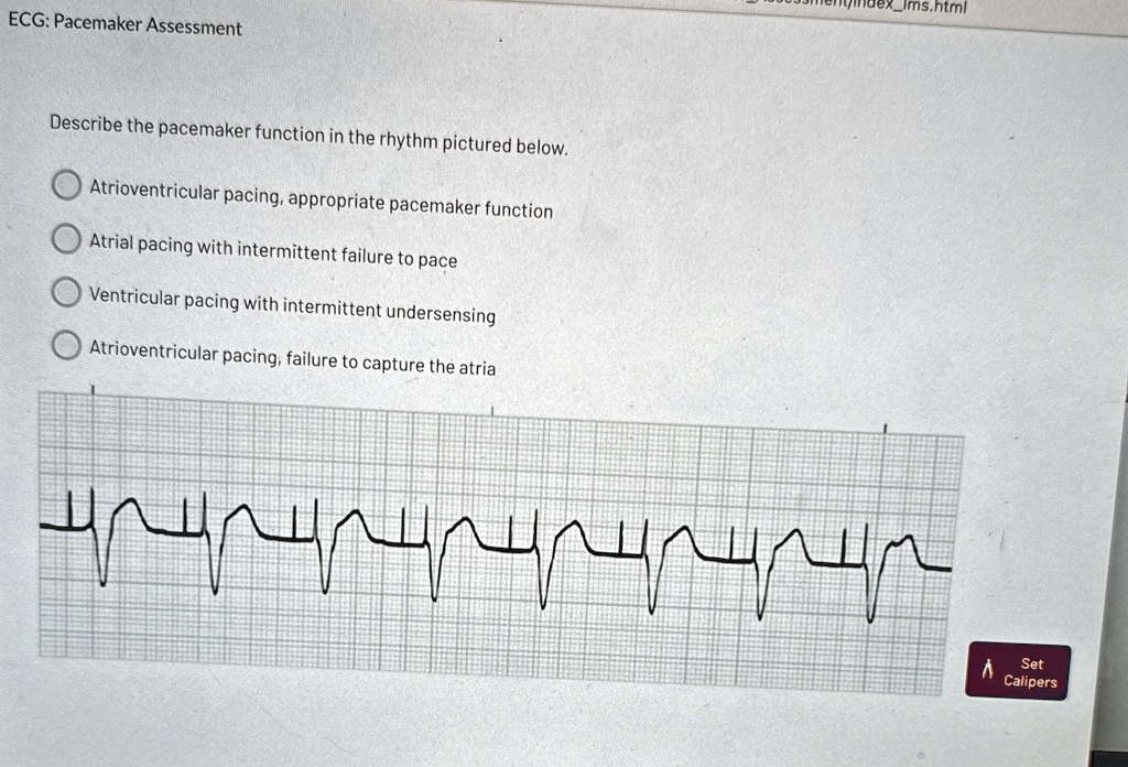 ecg pacemaker assessment describe the pacemaker function in the rhythm ...