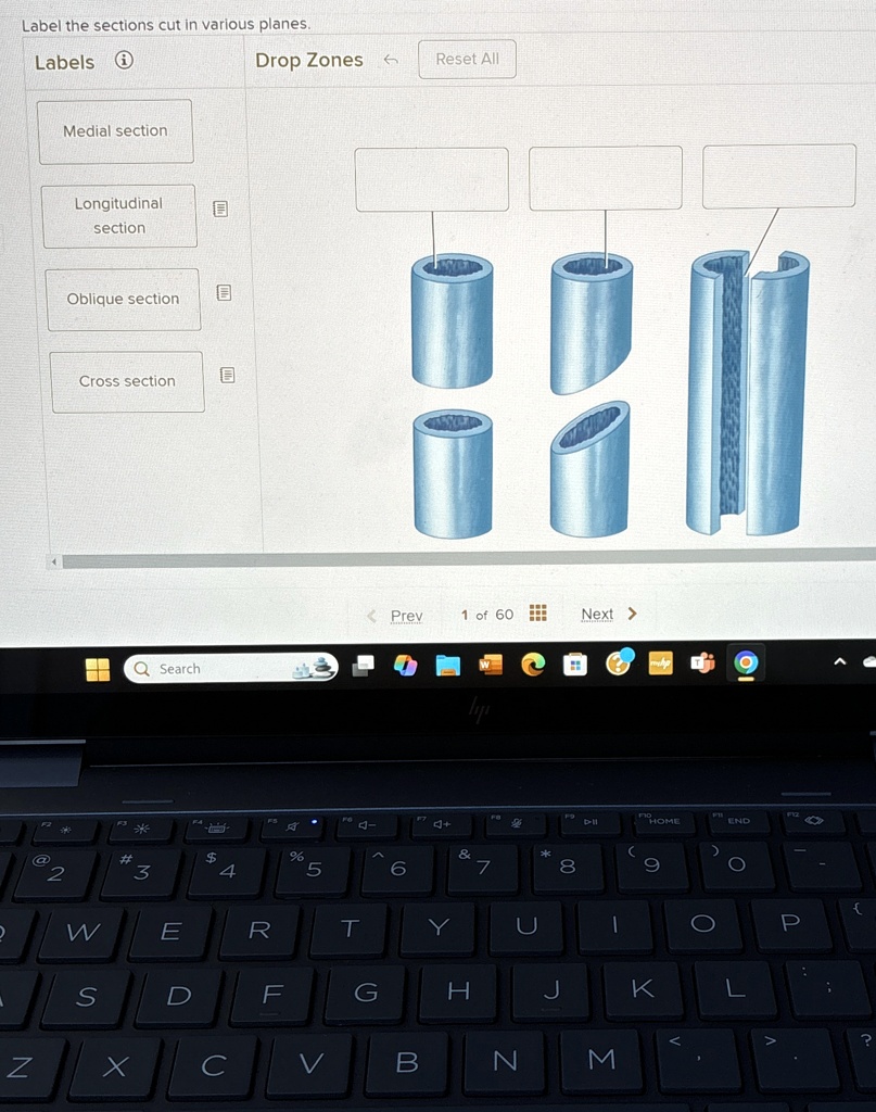 Label the sections cut in various planes. Labels Medial section Longitudinal section Oblique ...