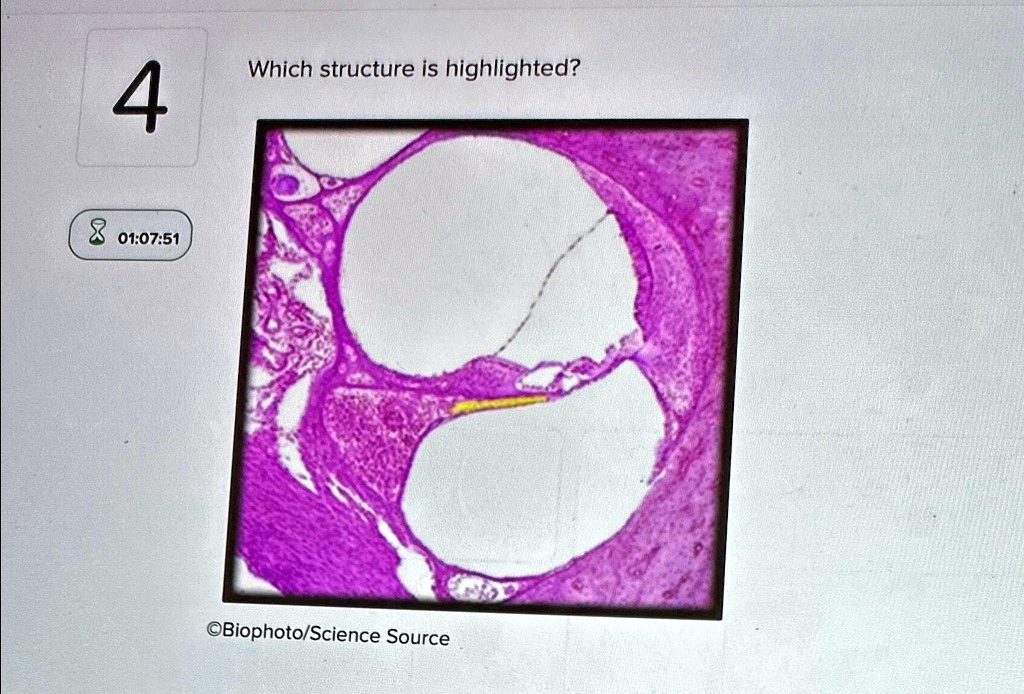 4 Which structure is highlighted? Which structure is highlighted? 01:07 ...