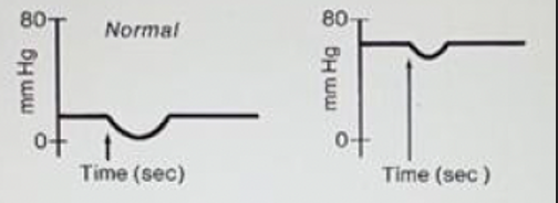 SOLVED: A 23-year-old woman has difficulty swallowing, regurgitation ...