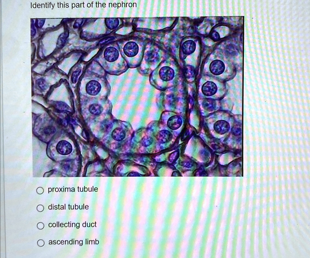 Identify this part of the nephron ? proximal tubule ? distal tubule ...