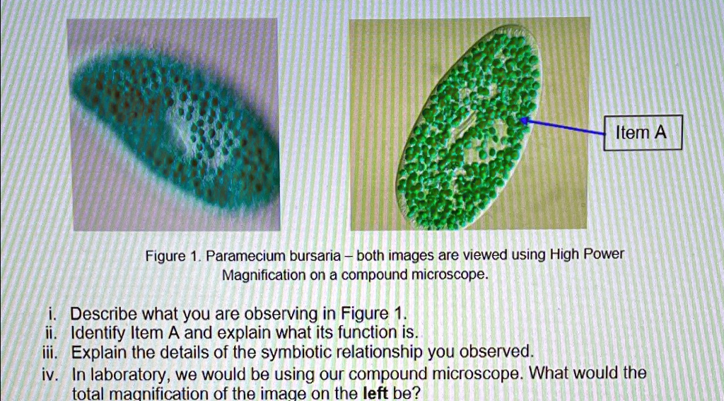 Figure 1. Paramecium bursaria - both images are viewed using High Power ...