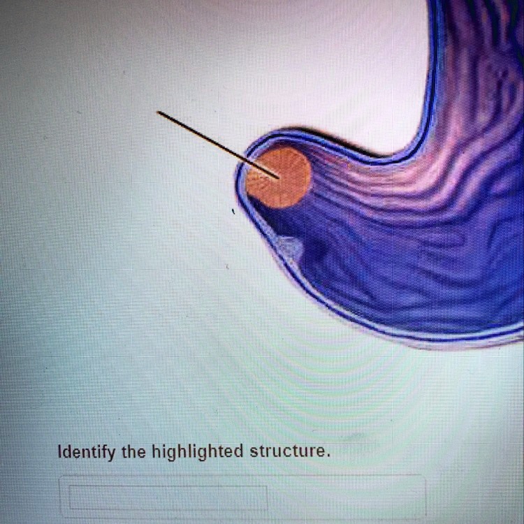 SOLVED: 'This is the kidney, but what is the structure? Identify the ...