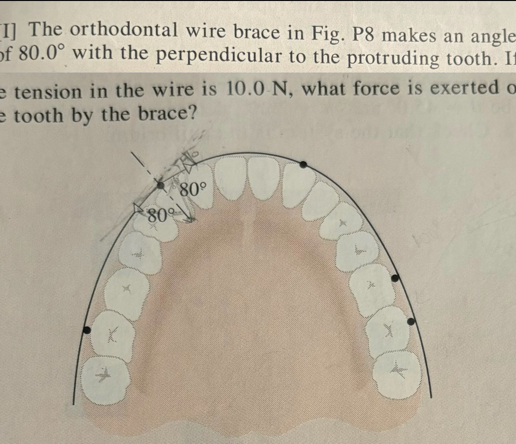 i the orthodontal wire brace in fig p8 makes an angle f 800circ with ...