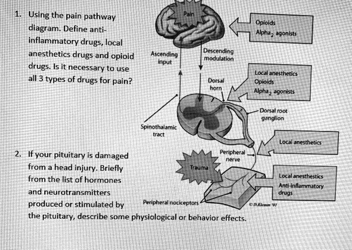 SOLVED:Using the pain pathway diagram. Define anti- inflammatory drugs ...