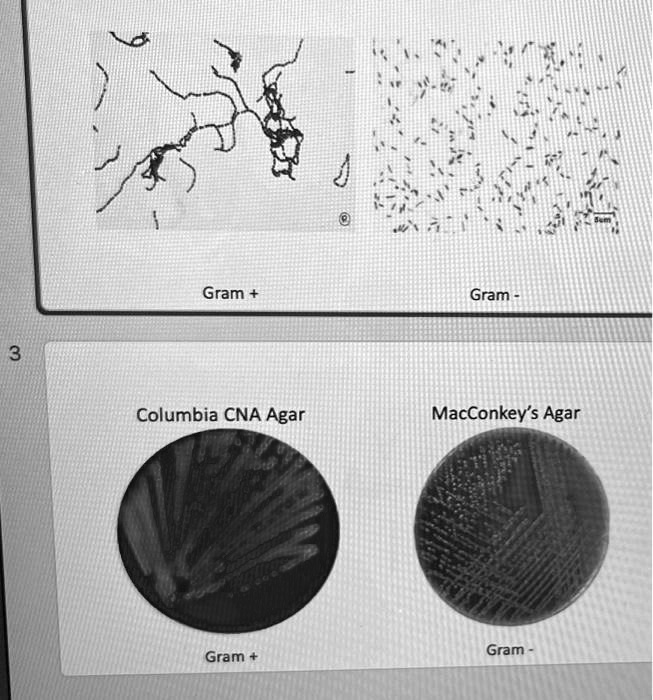SOLVED: identify the gram positive and gram negative bacterias in the ...