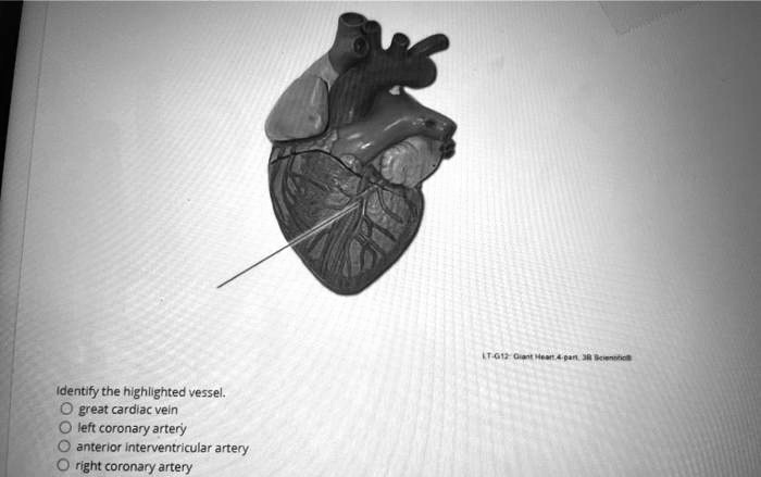 Identify the highlighted vessel. O great cardiac vein O left coronary artery O anterior ...