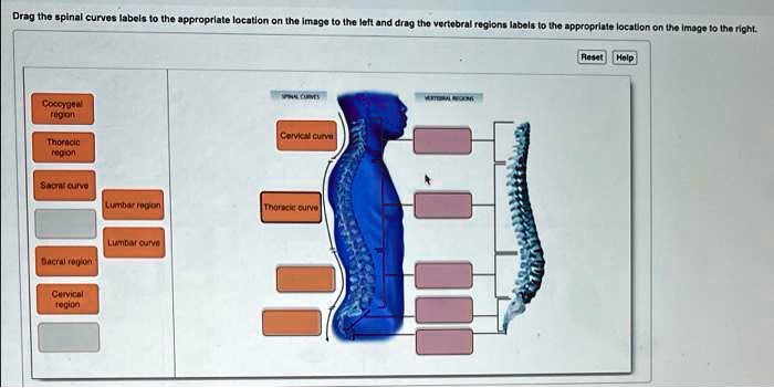 SOLVED: Drag the spinal curves labels to the appropriate location on the image to the left and ...