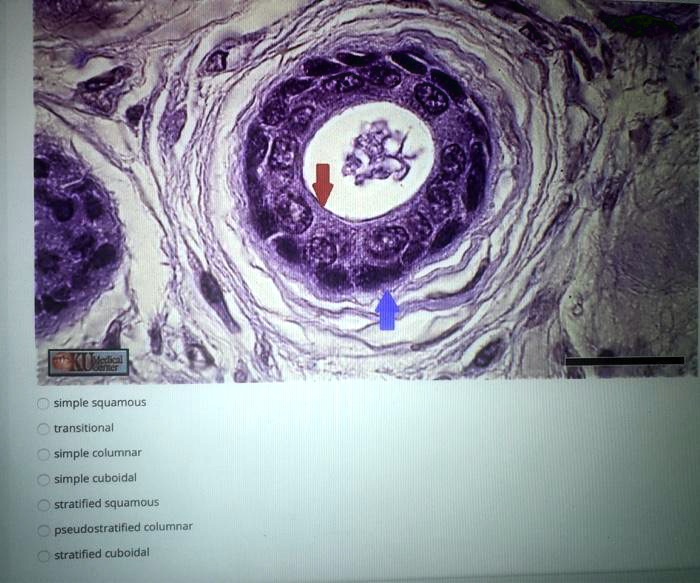 SOLVED: simple squamous transitional simple columnar simple cuboidal stratified squamous ...