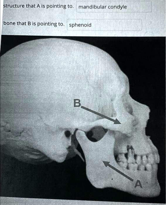 Structure that A is pointing to: mandibular condyle. Bone that B is ...