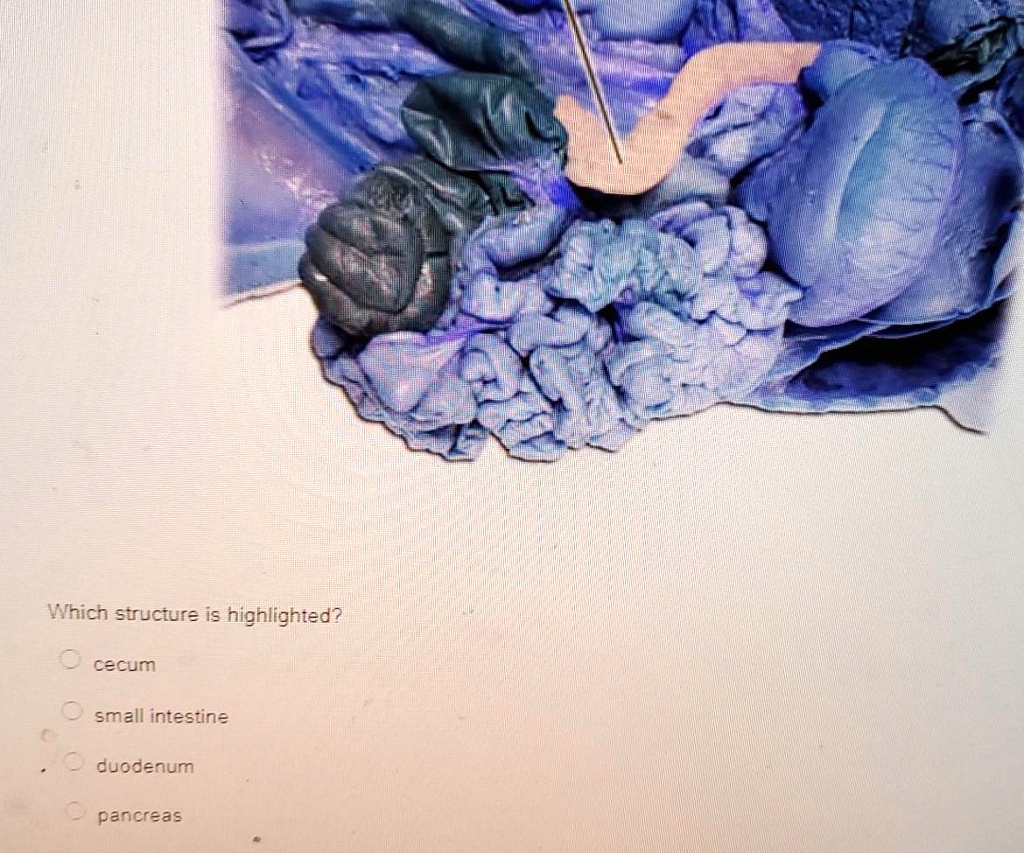 SOLVED: which structure is highlighted? Which structure is highlighted ...