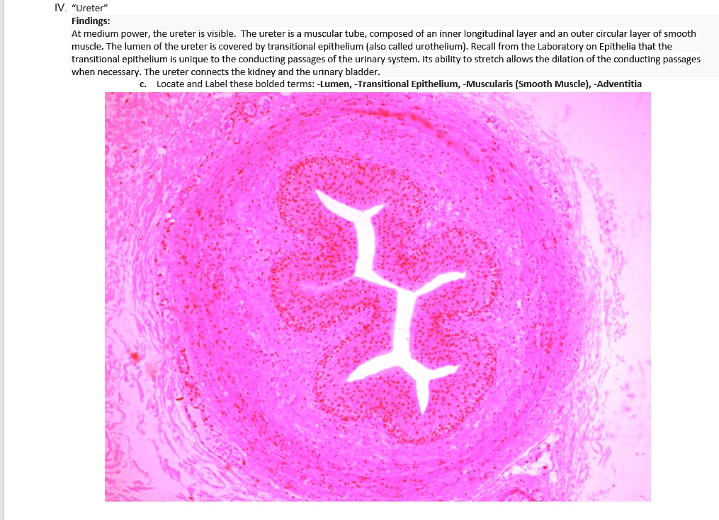 SOLVED: Ureter" Findings: At medium power, the ureter is visible. The ...