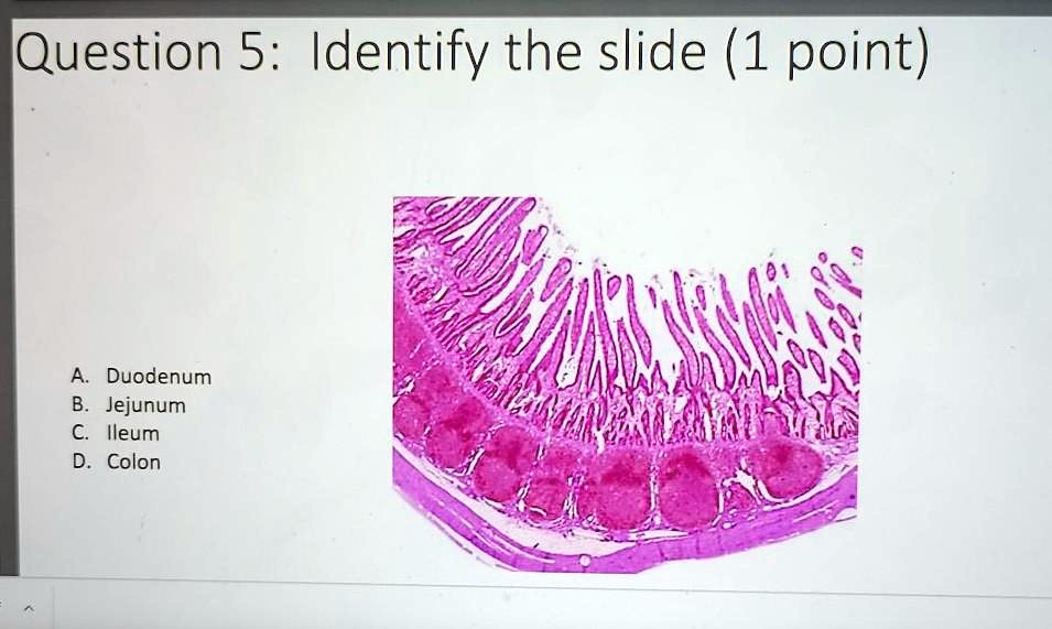 SOLVED: Question 5: Identify the slide (1 point) Duodenum Jejunum C ...