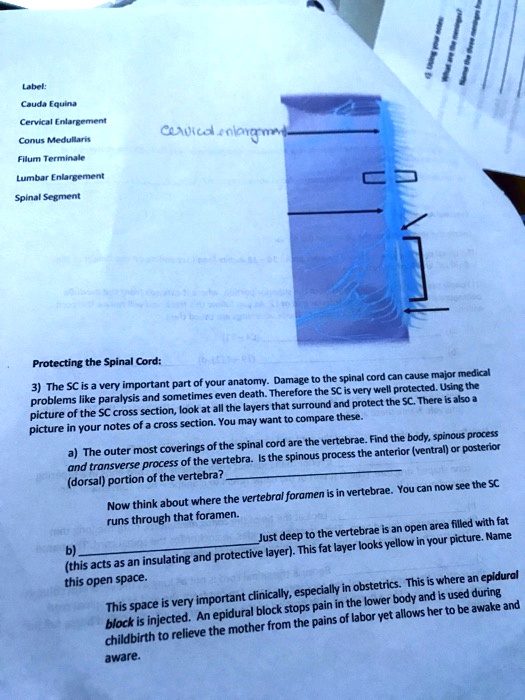 SOLVED: Cauda Equina Cervical Enlargement Conus Medullaris Filum ...