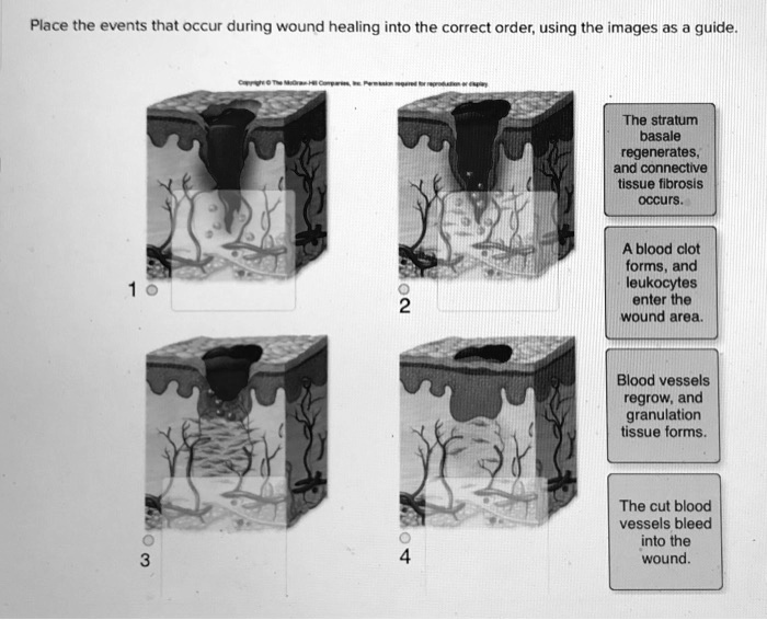 SOLVED: Place the events that occur during wound healing into the ...