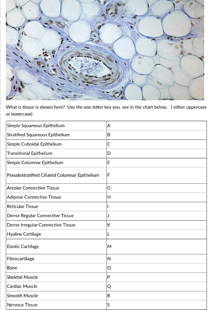 SOLVED: What is tissue is shown here? Use the one letter key you see in ...