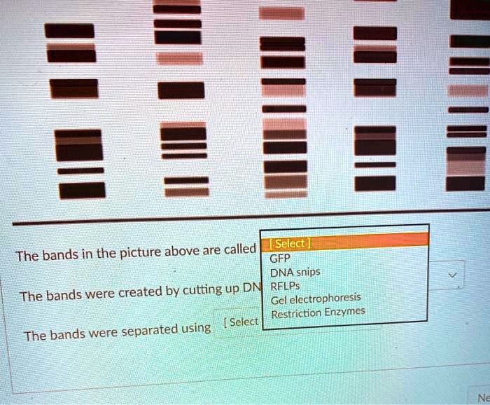 SOLVED: Selcct) The bands in the picture above are called GFP DNA snips ...