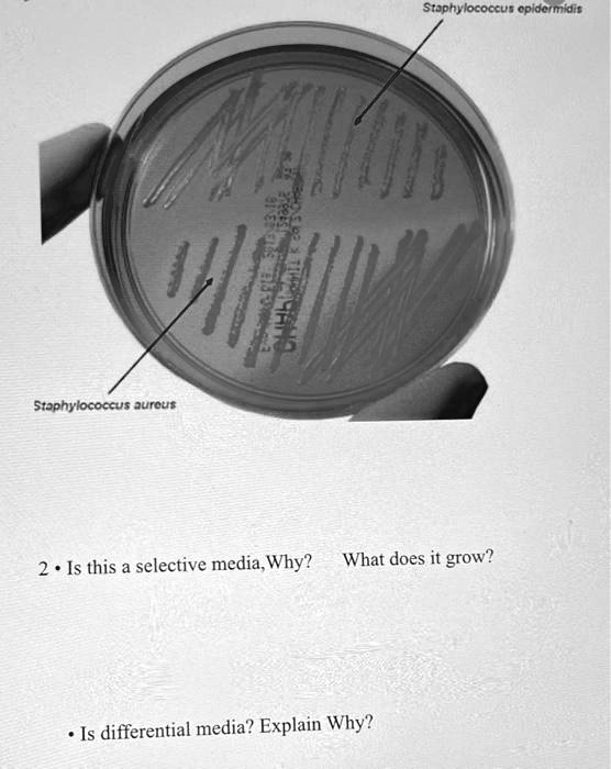 Staphylococcus aureus Staphylococcus epidermidis 2. Is this a selective ...