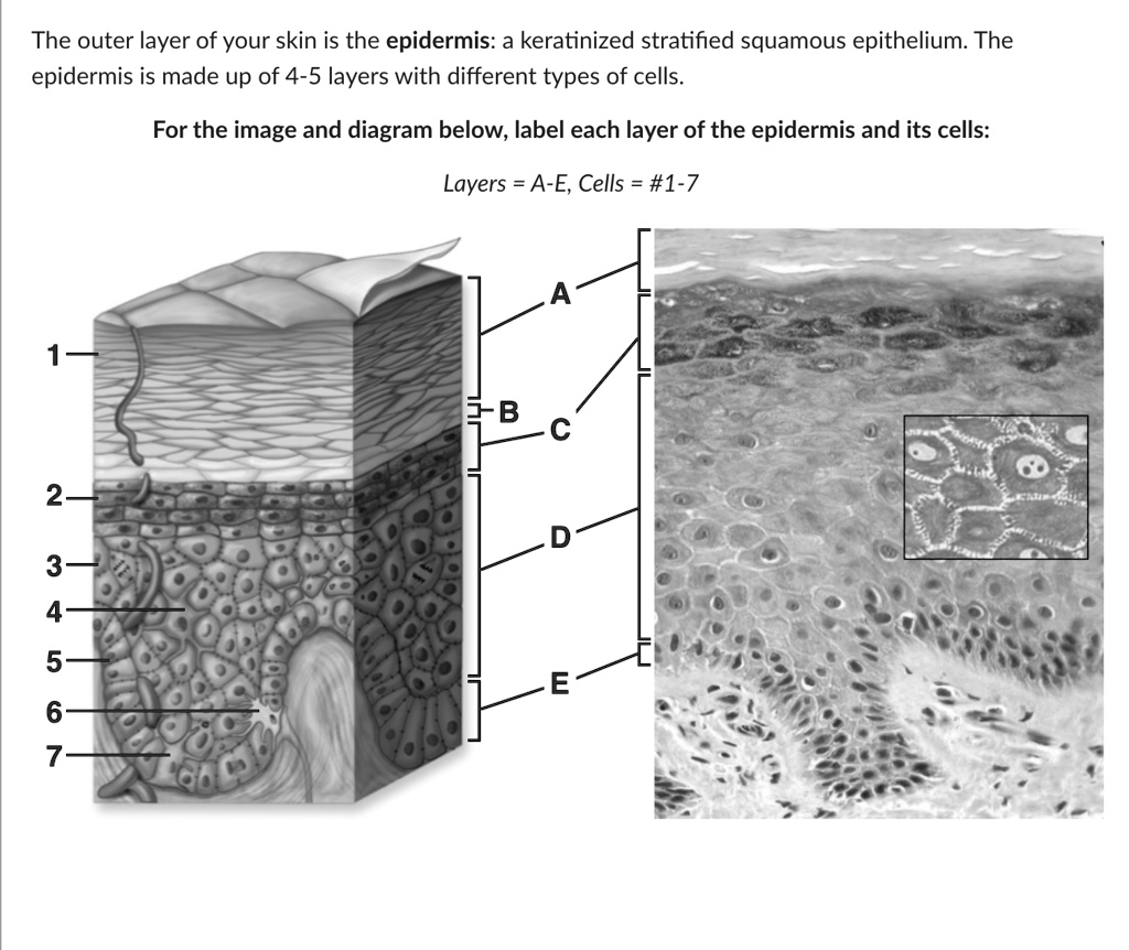 SOLVED: 'The outer layer of your skin is the epidermis: a keratinized ...
