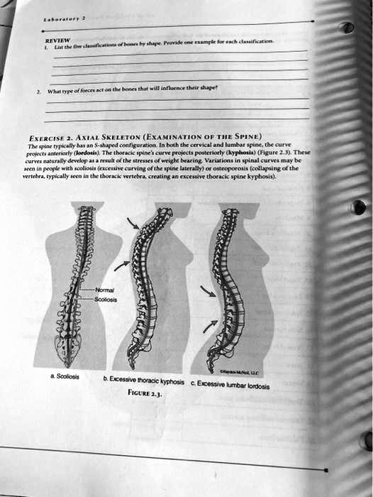 SOLVED: REVIEW EXERCISE 2. AXIAL SKELETON (EXAMINATION OF THE SPINE ...