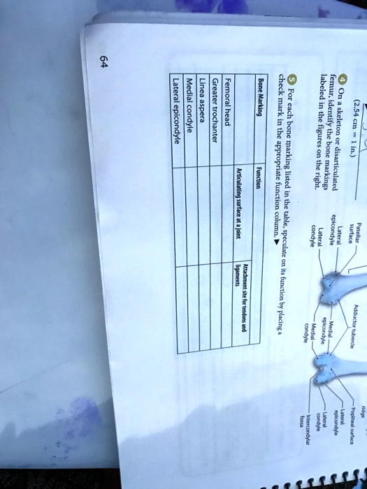 SOLVED: Lateral epicondyle Medial condyle Linea aspera Greater trochanter Femoral head Bone ...