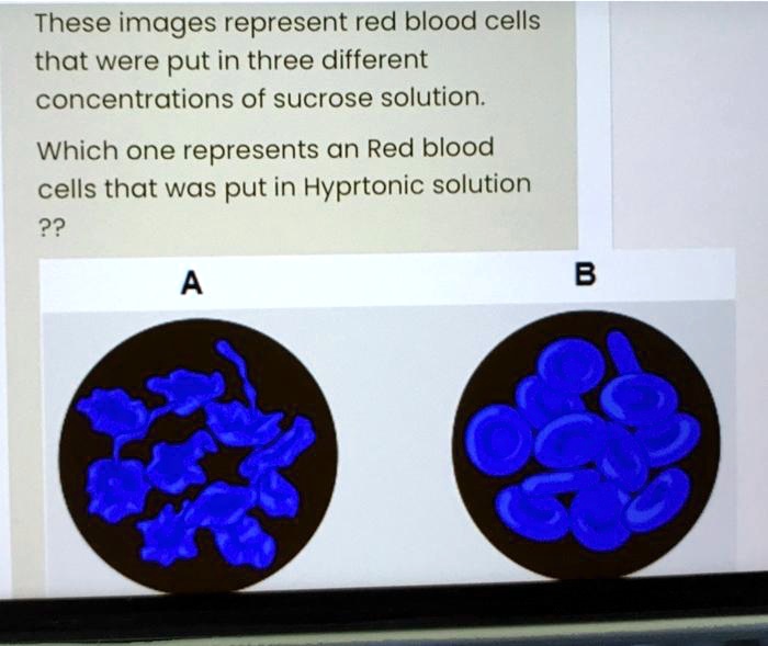 these images represent red blood cells that were put in three different ...