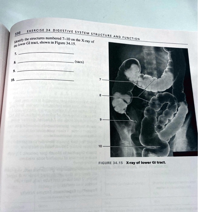 SOLVED: 598 8. (sacs) 9. 10. 10 FIGURE 34.15 - X-ray of lower GI tract.