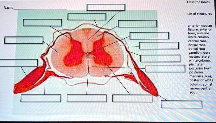 SOLVED: Name: List of structures anterior median fissure, anterior horn ...