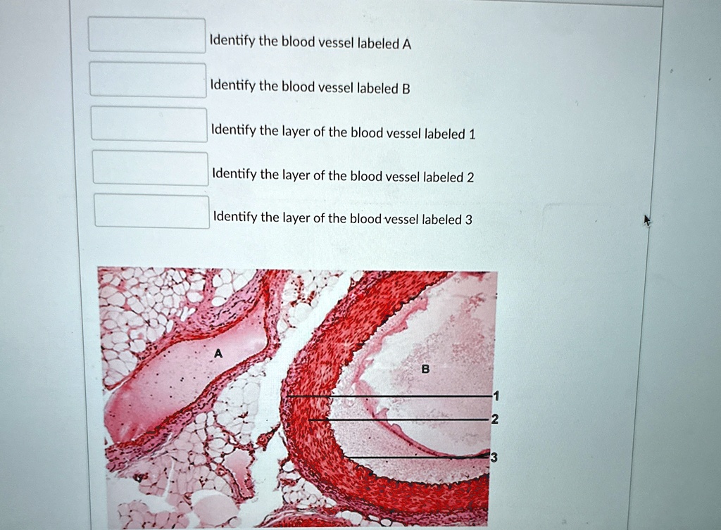 identify the blood vessel labeled a identify the blood vessel labeled b identify the layer of ...