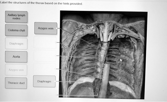 Label the structures of the thorax based on the hints provided: - Axillary lymph nodes - Azygos ...