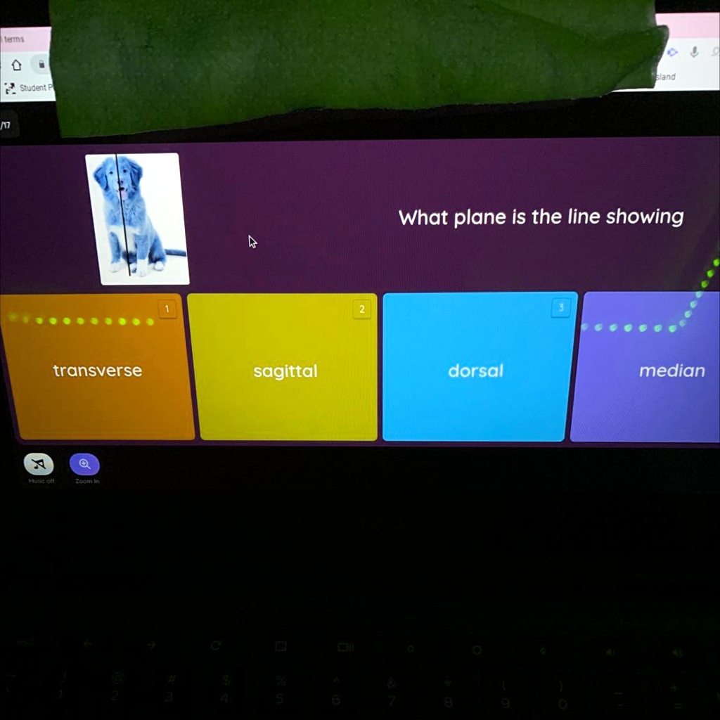 SOLVED: 'What plane is the line showing? transverse sagittal dorsal ...