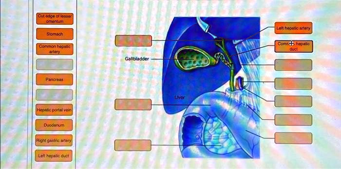 SOLVED: Cut edge of lesser omentum Stomach Common hepatic artery ...