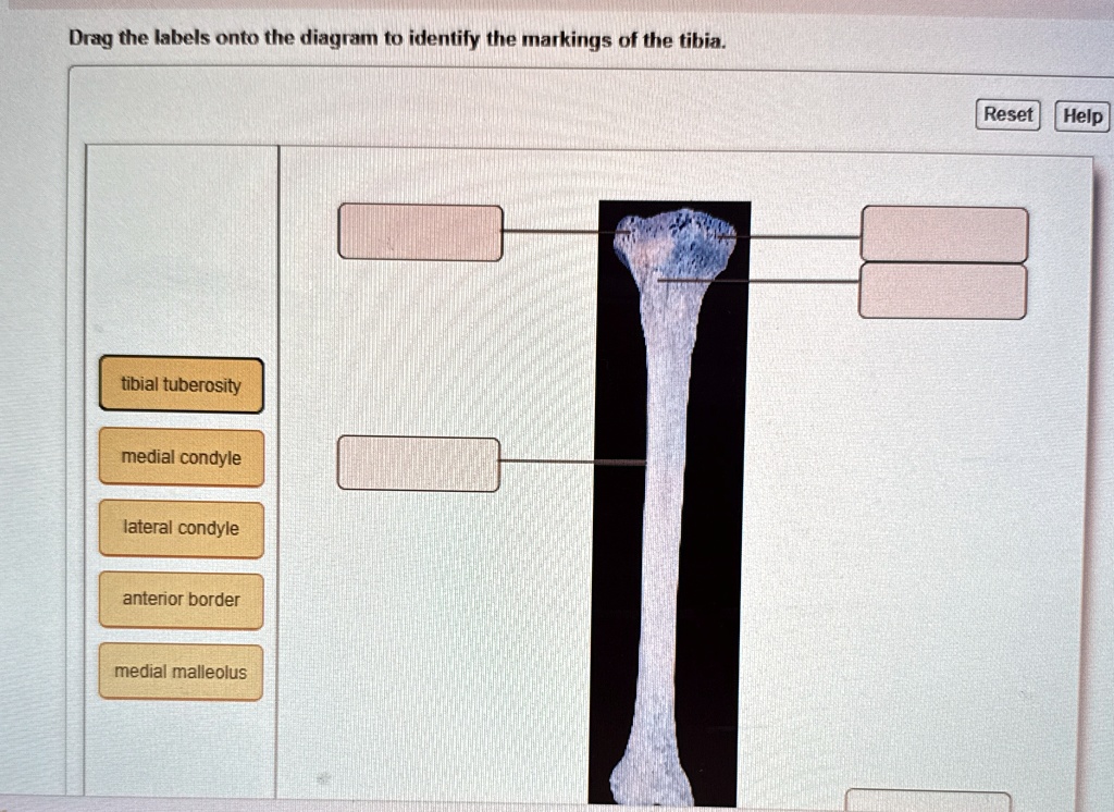 drag the labels onto the diagram to identify the markings of the tibia ...