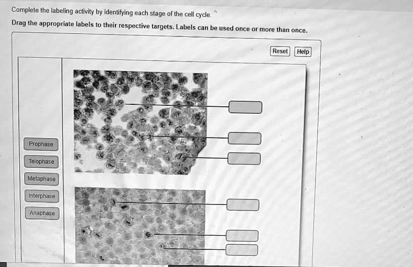 SOLVED: Complete the labeling activity by identifying each stage of the ...