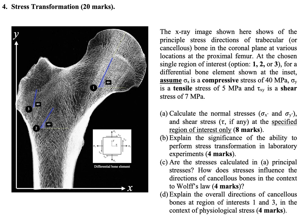SOLVED: 4. Stress Transformation (20 marks) The x-ray image shown here ...