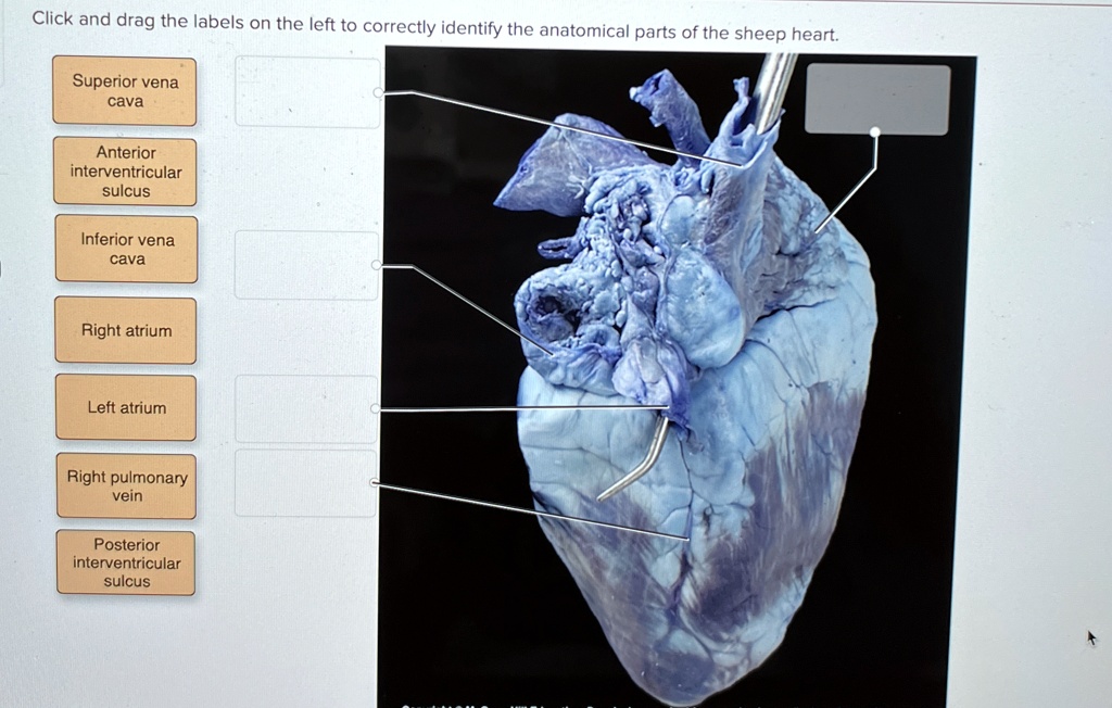 click and drag the labels on the left to correctly identify the ...