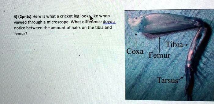 SOLVED: 4) (Zpnts) Here is what a cricket leg look: like when vlewed ...