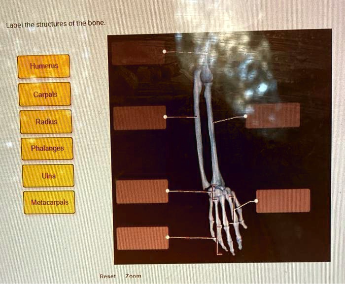 Label the structures of the bone: Humerus Carpals Radius Phalanges Ulna ...