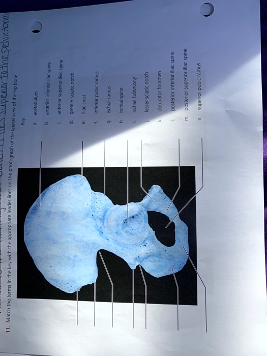 SOLVED: Esser sciatic notch, obturator foramen, posterior inferior ...